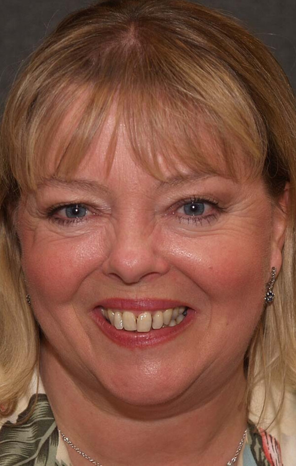 Sue Hodge - actress - biography, photo, best movies and TV shows